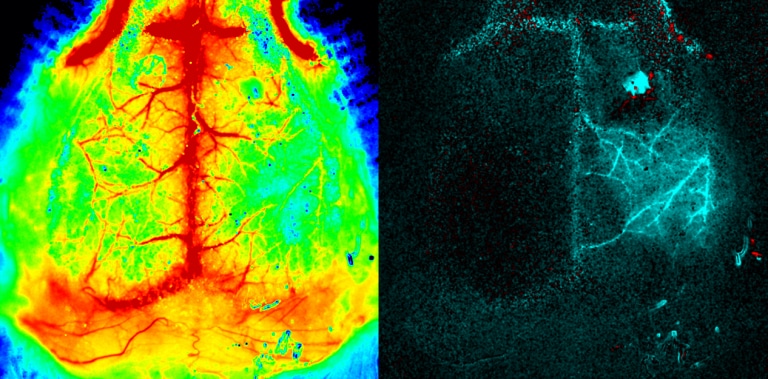 脑血流监测 (Cerebral Blood Flow Monitoring) - Perimed