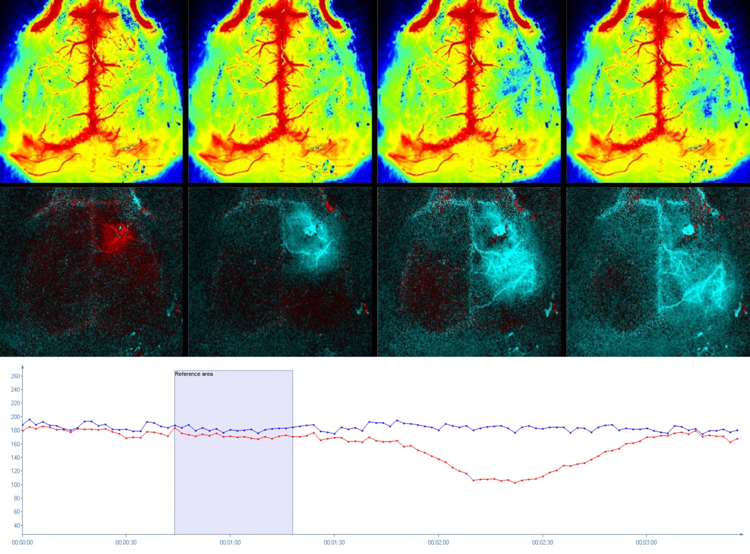 脑血流监测 (Cerebral Blood Flow Monitoring) - Perimed