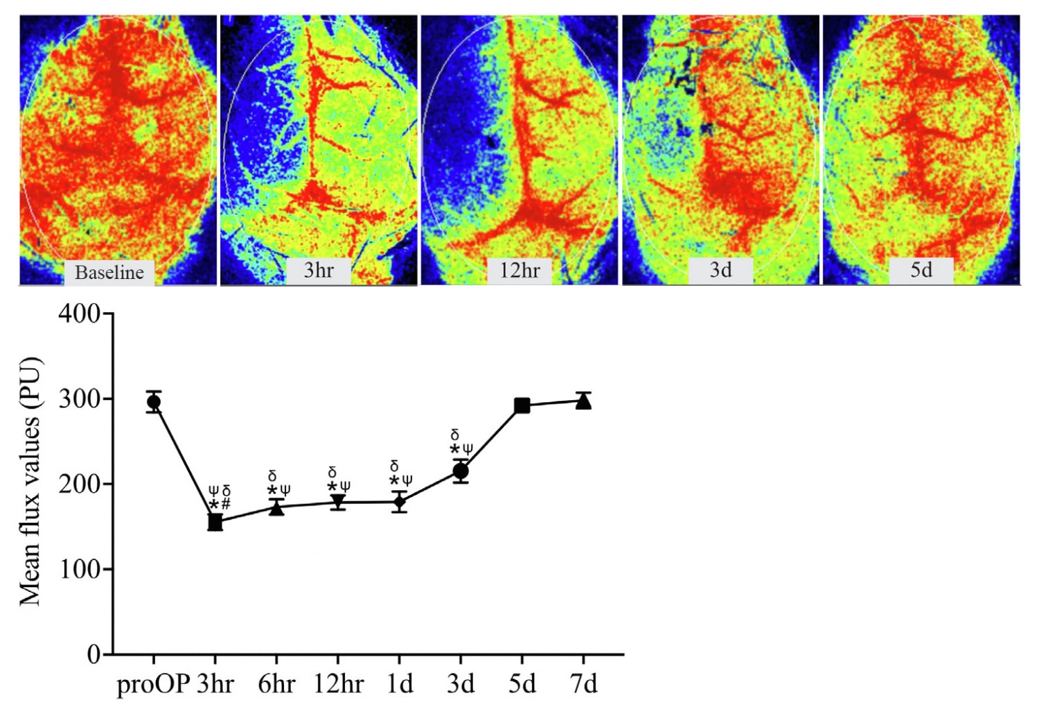 脑血流监测 (Cerebral Blood Flow Monitoring) - Perimed