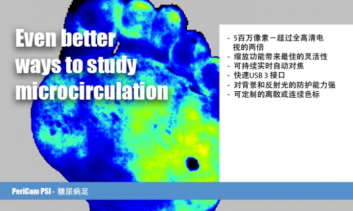 Perimed - World-leading in instruments for Peripheral Vascular Diagnosis